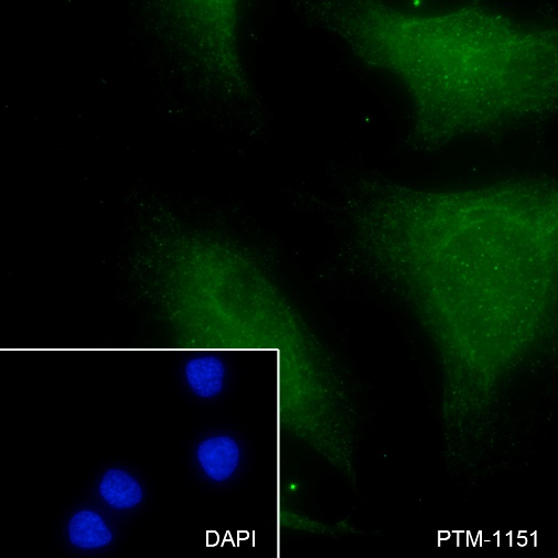 PTM BIO