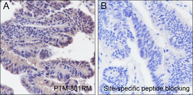 PTM BIO