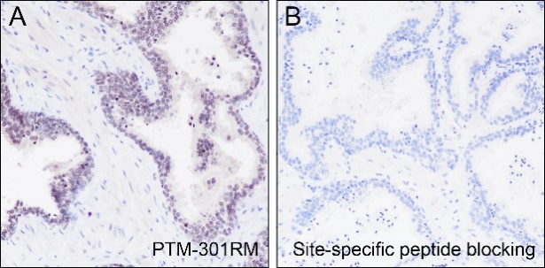 PTM BIO