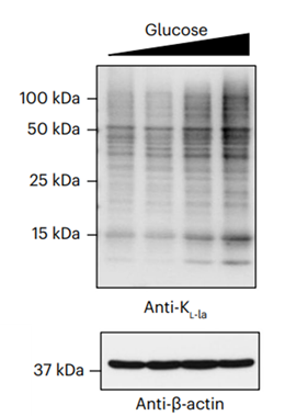 PTM BIO