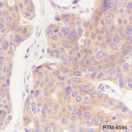 PTM BIO